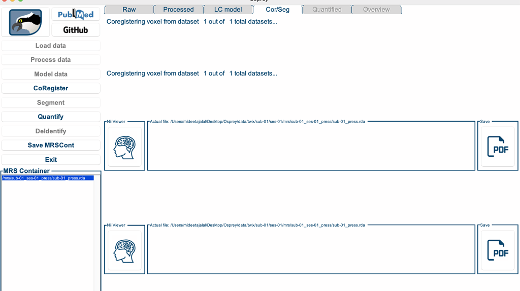 Error in CoRegistration Function of Osprey - Osprey - MRSHub Forum